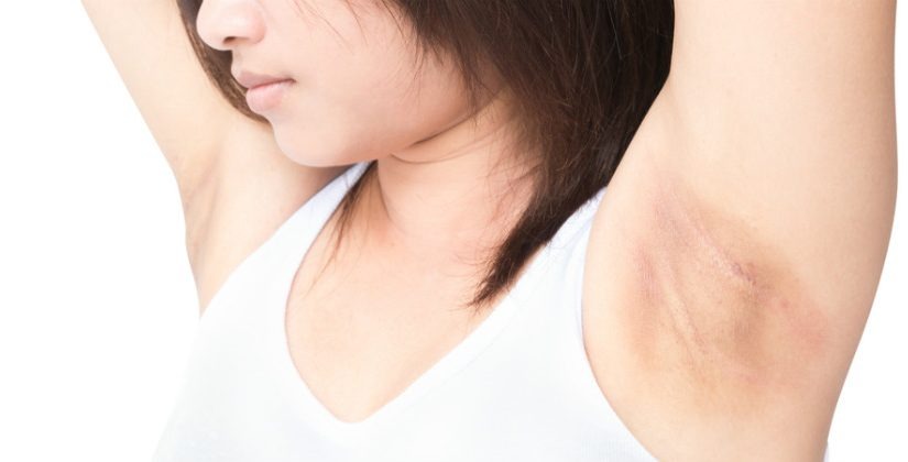 Dor na Axila - 9 Causas e o Que Fazer